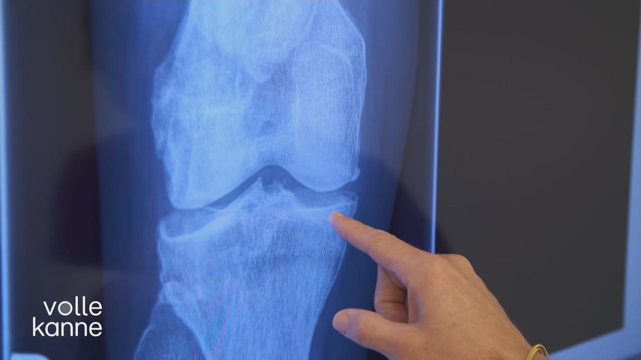 Behandlung von Knie-Arthrose