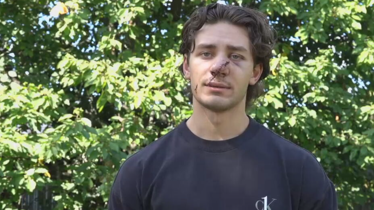 Messerattacke auf US-Bürger in Dresden: 20-Jähriger stellt sich