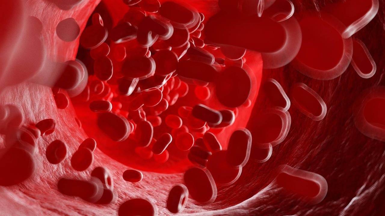 Thrombose im Arm
